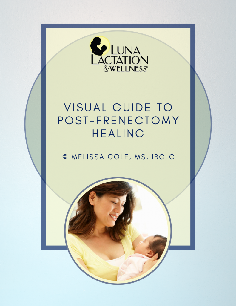 Visual Guide to Post-Frenectomy Healing | Luna Lactation & Wellness